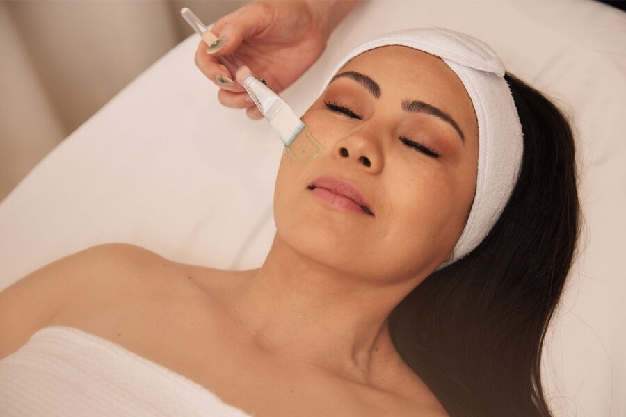 Chemical Peels in Chino Hills, CA | Saint Savant Medical Aesthetics
