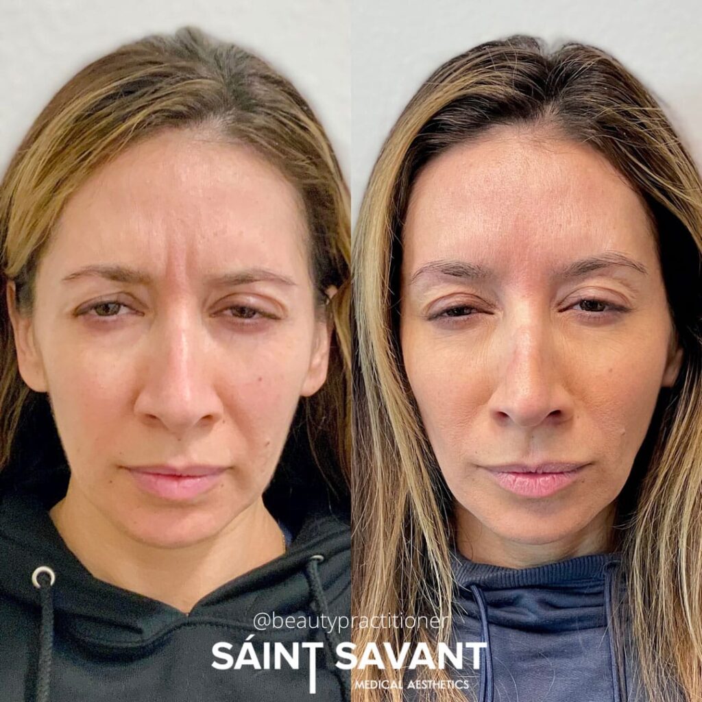 Gallery | Saint Savant Medical Aesthetics in Chino Hills