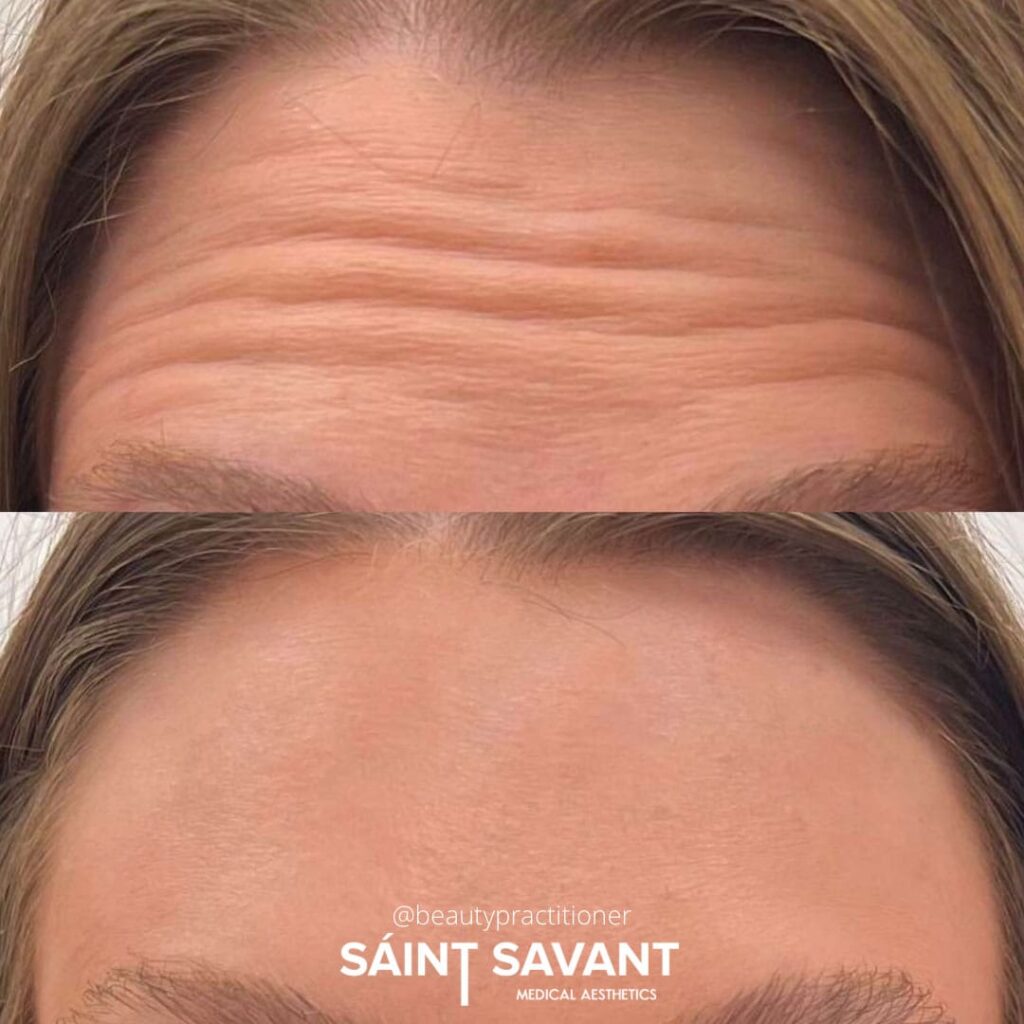 Gallery | Saint Savant Medical Aesthetics in Chino Hills