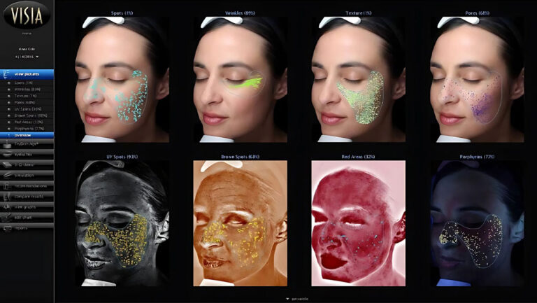 VISIA Skin Analysis in Chino Hills, CA | SÁINT SAVANT