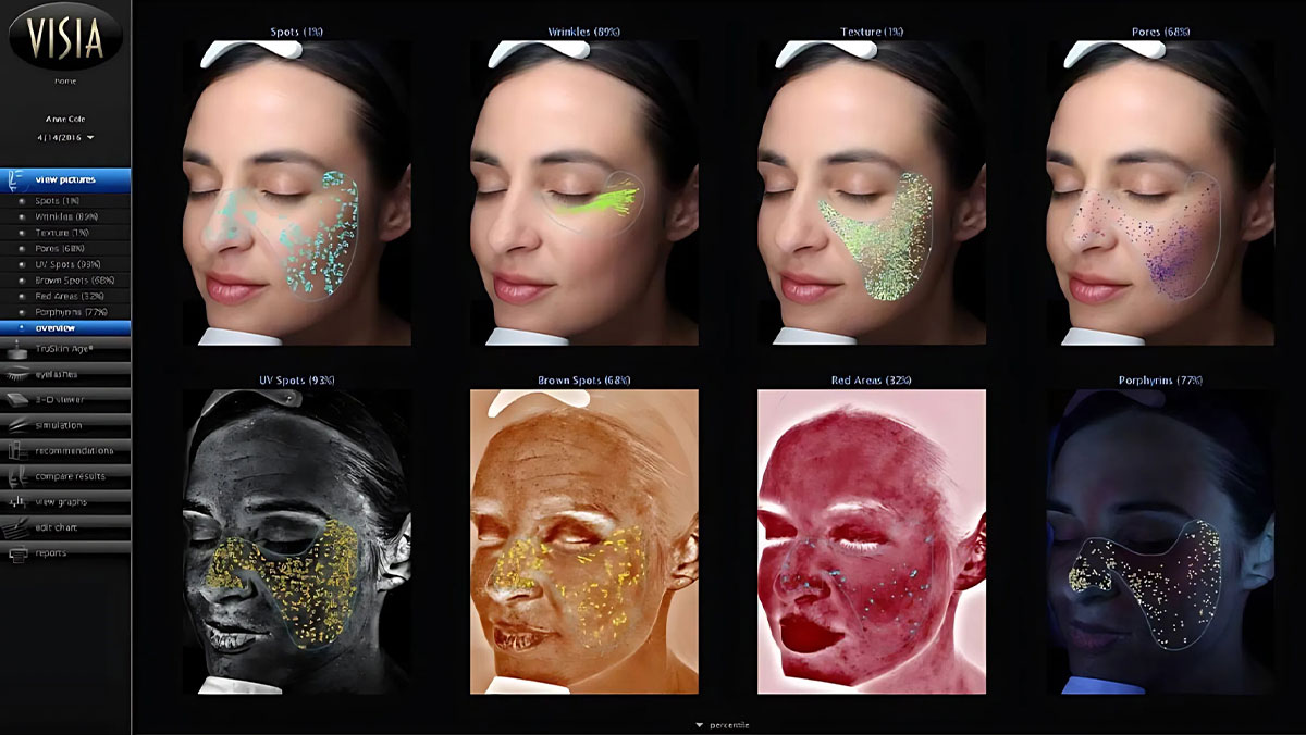 VISIA Skin Analysis in Chino Hills, CA | SÁINT SAVANT